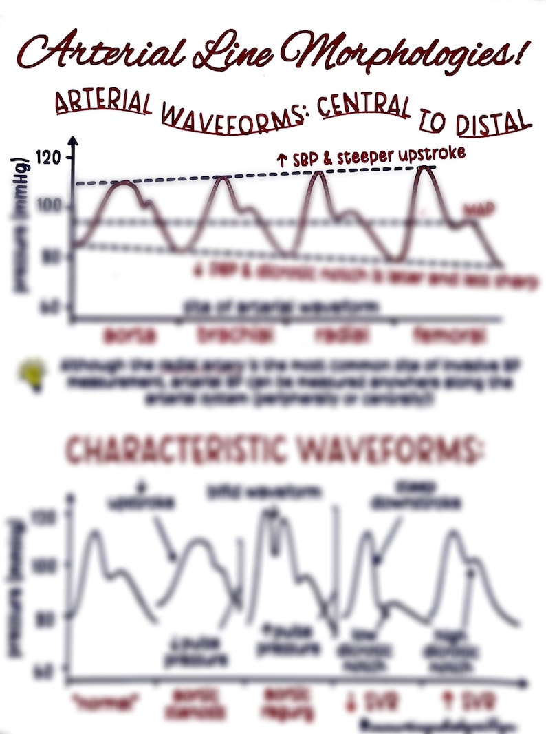 The Arterial Line (ABP) Waveform - Etsy