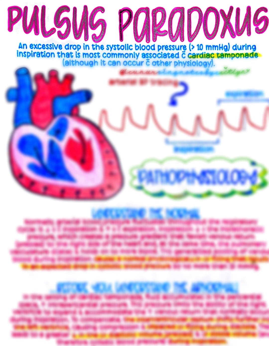 Pulsus Paradoxus - Etsy