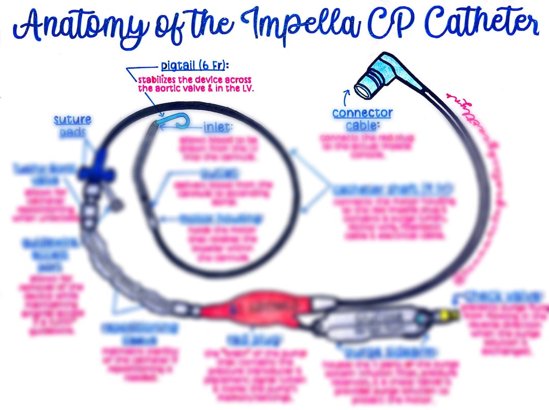 Anatomy of the Impella CP® Catheter - Etsy UK
