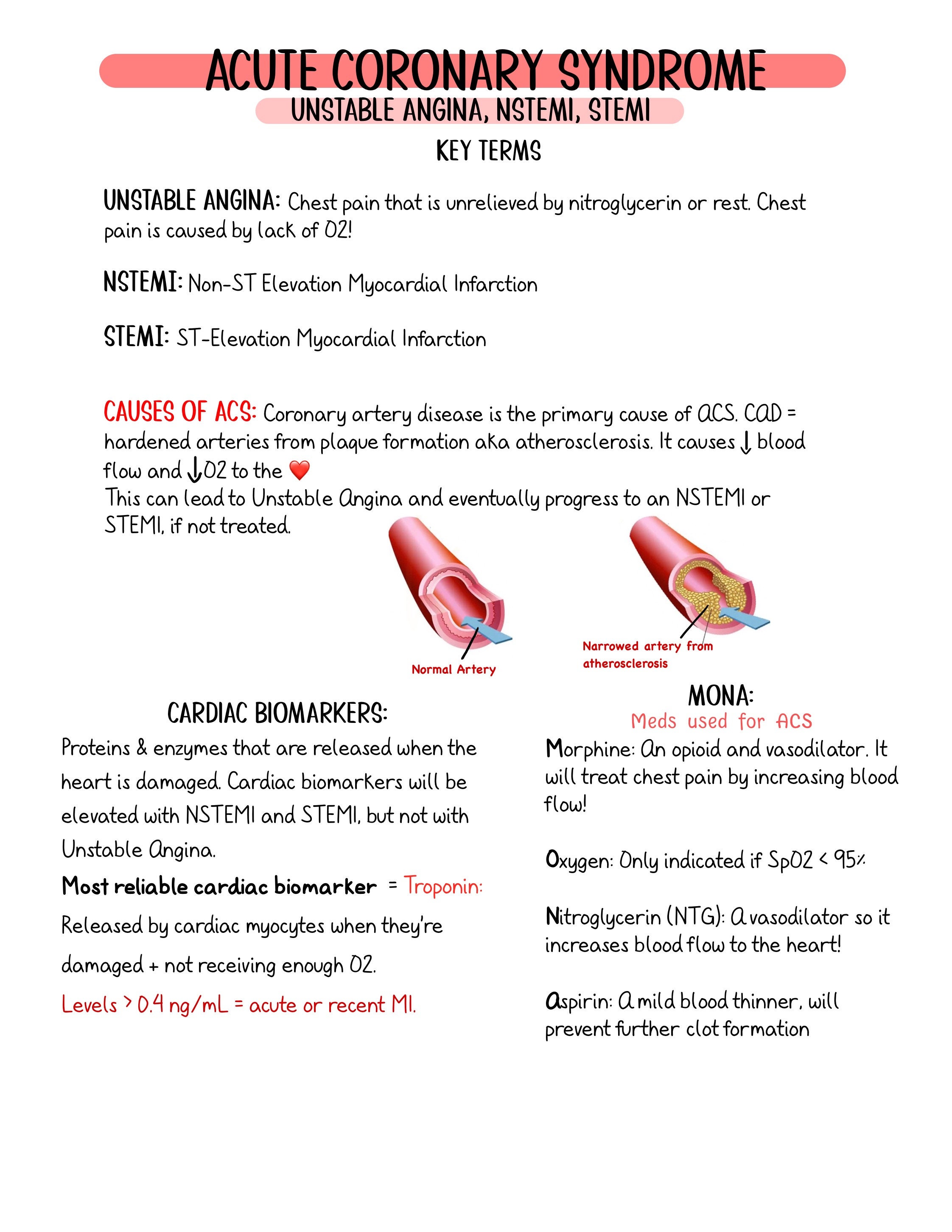 Myocardial Infarction | Unstable Angina | 5 Pages | Detailed ACS Review ...