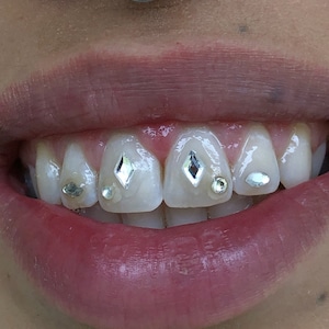 Diamond Form Crystals (swarovski) - Different Colors for Tooth Gems - Etsy