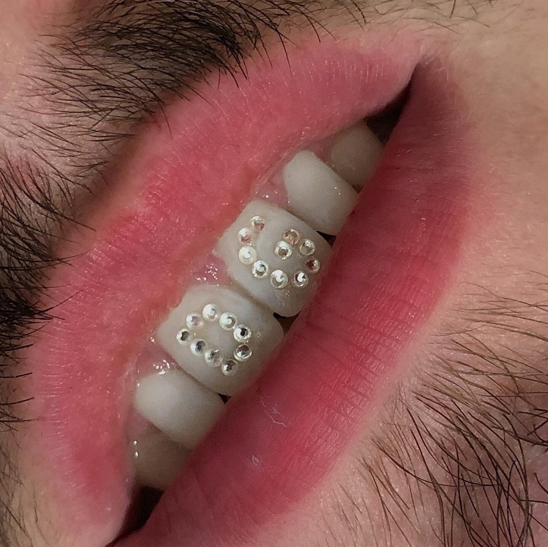 50x Mini 1.4 Mm Tooth Gems Ideal for Creative Sets - Etsy