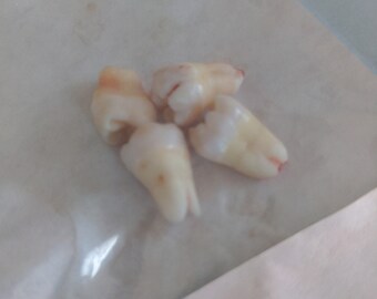 Wisdom Teeth | Etsy