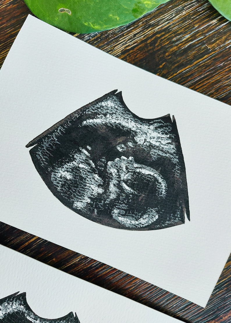 Hand-drawn Watercolor Ultrasound Art, Baby Sonogram Portrait - Etsy