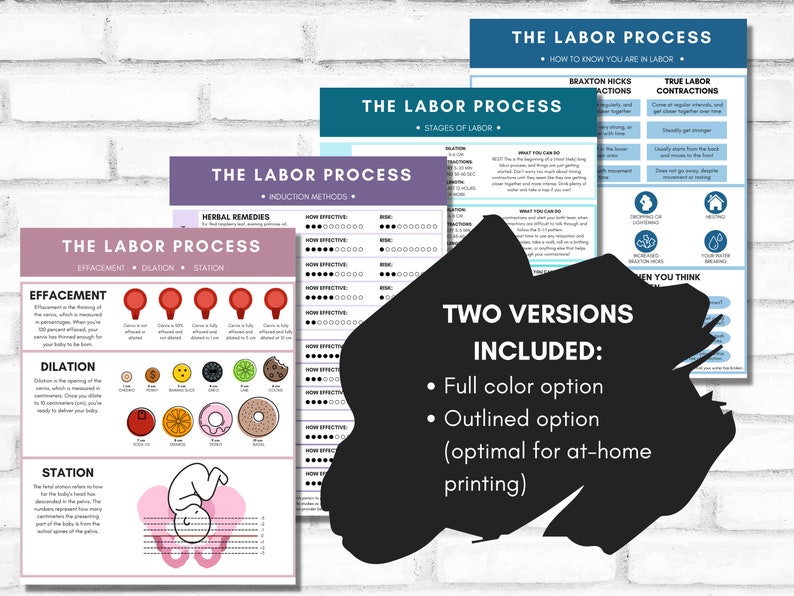 Labor Process BUNDLE- 4 Handouts on Effacement and Dilation, Induction ...