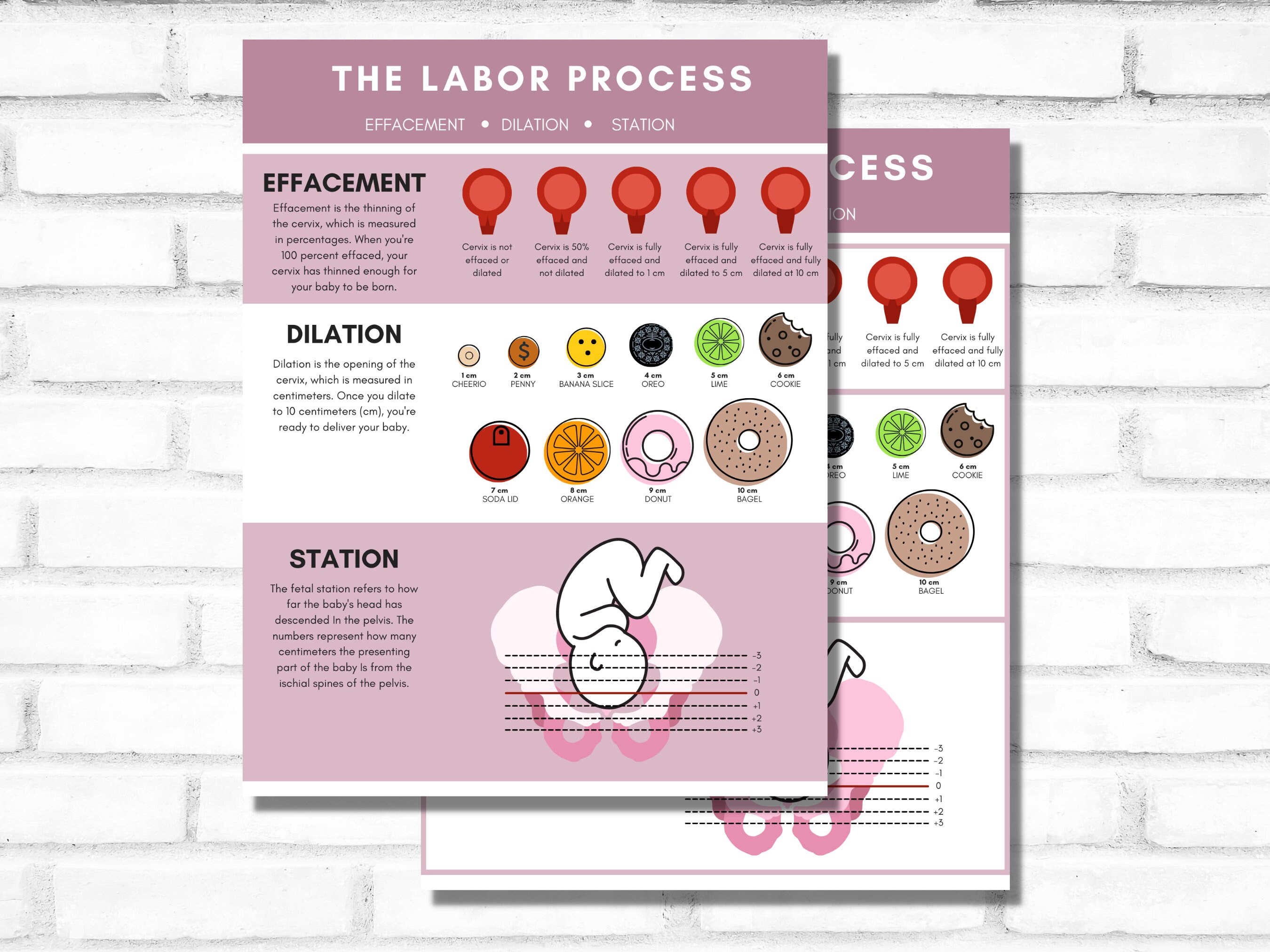 Labor Process BUNDLE- 4 Handouts on Effacement and Dilation, Induction ...