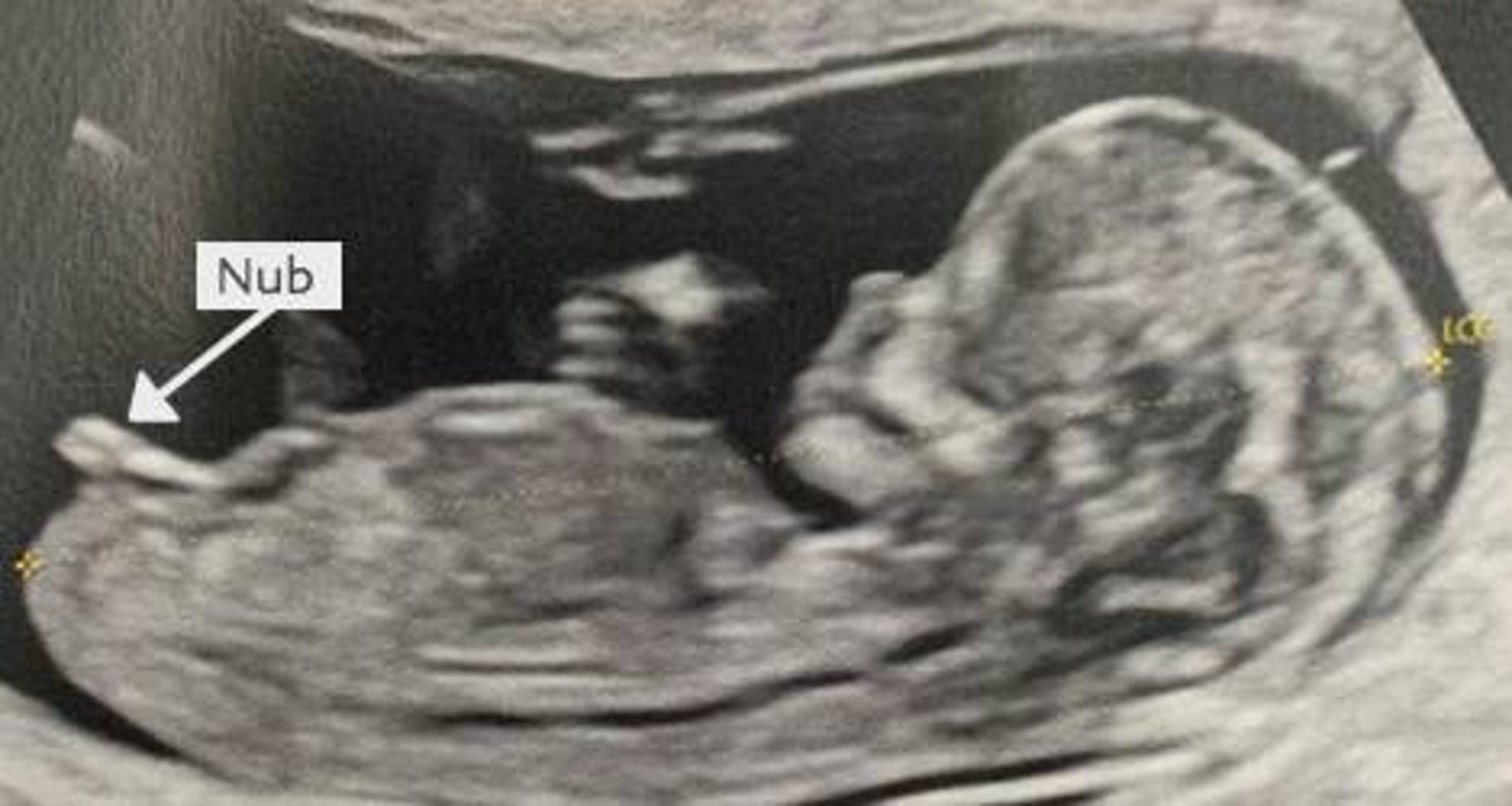 What is the Gender of the Baby? Girl or Boy? - Etsy