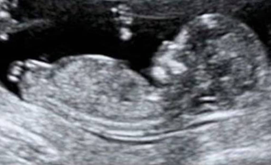 What is the Gender of the Baby? Girl or Boy? - Etsy