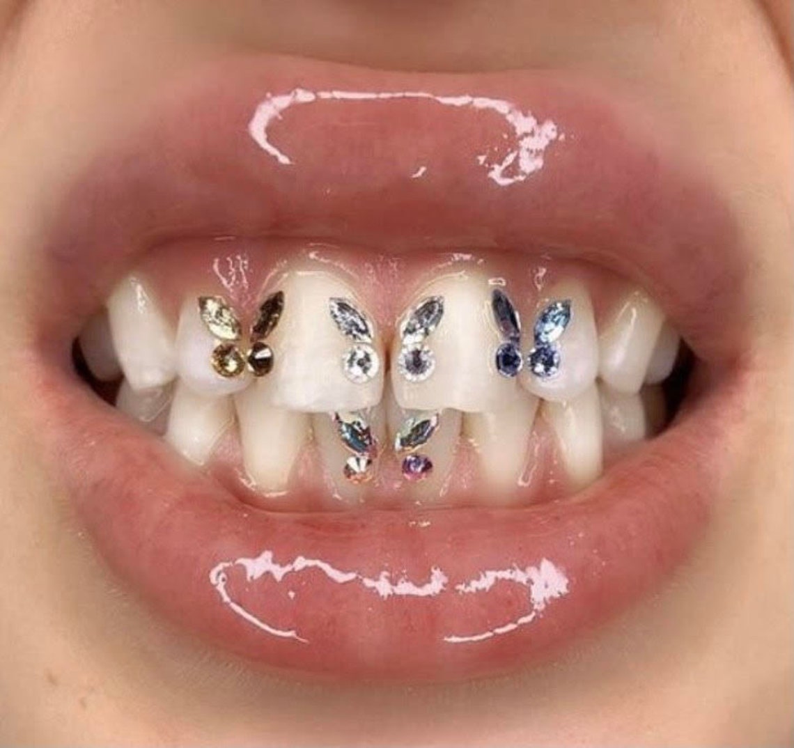 BUTTERFLY Tooth Gem | Etsy