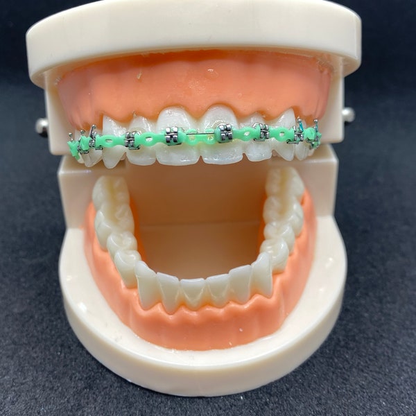 Braces Teeth - Etsy