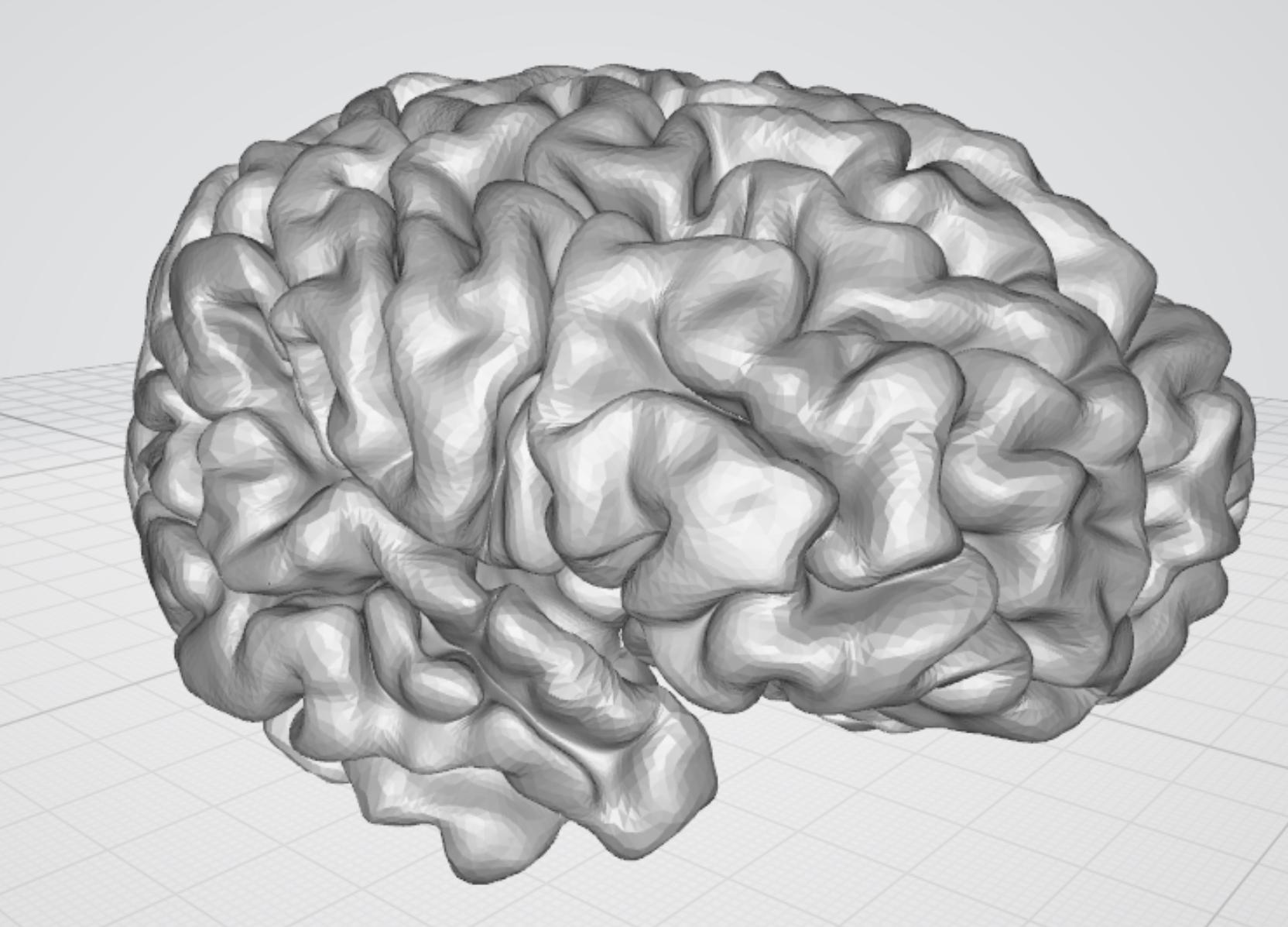 Your Brain 3D Printed From MRI Files - Etsy