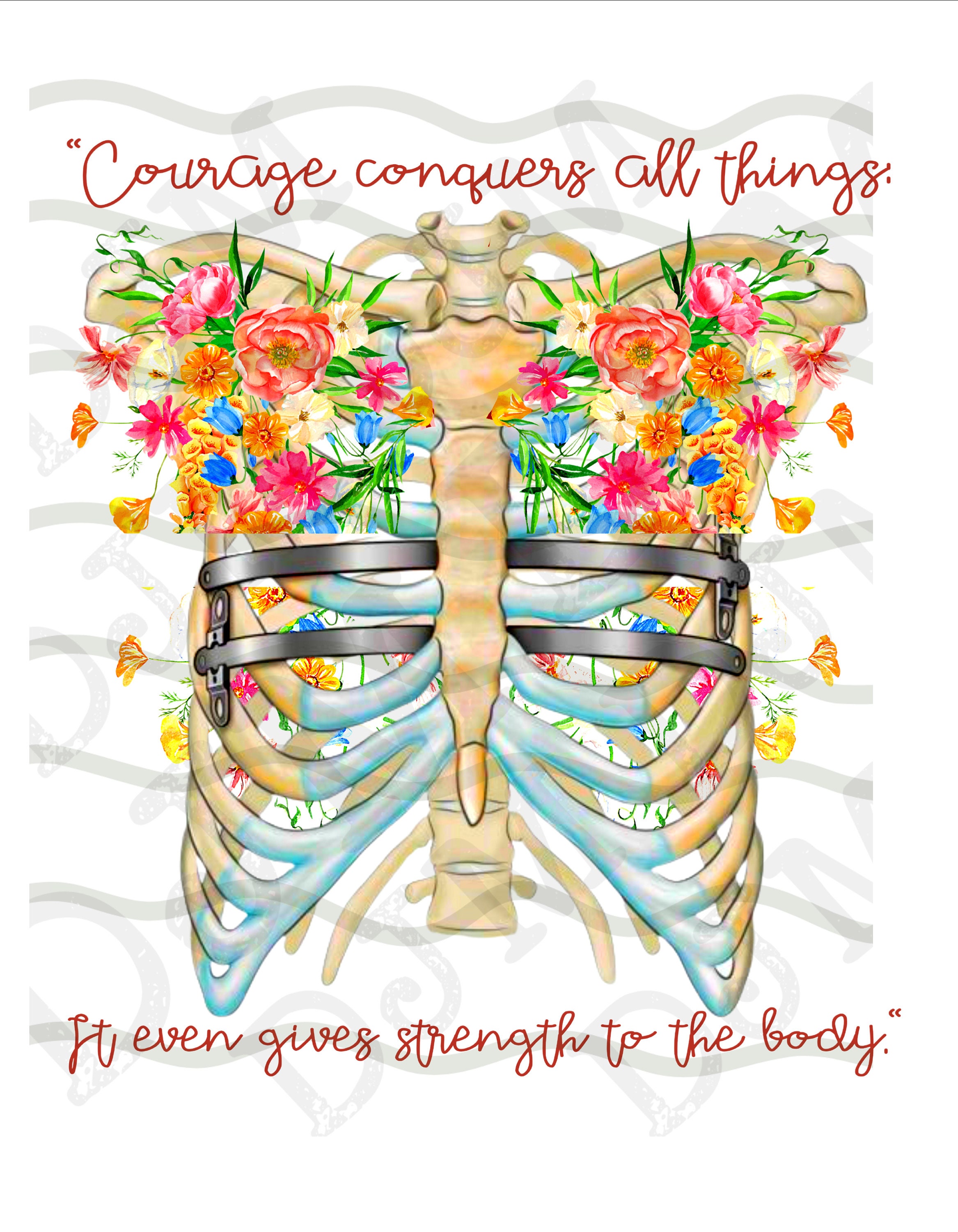 Pectus Excavatum Inspired Shirt Nuss Bar - Etsy