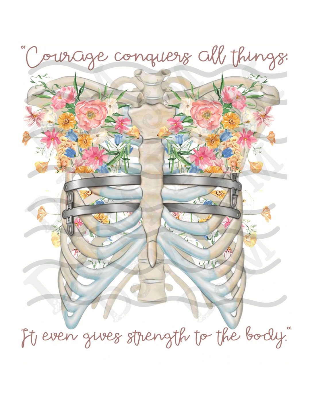 Pectus Excavatum Inspired Shirt Nuss Bar - Etsy