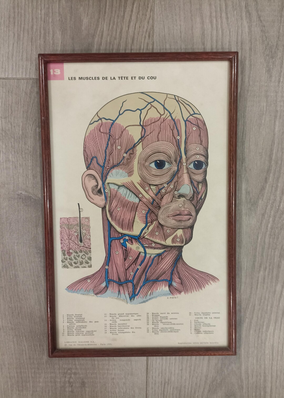 Frame Anatomy Board Framed Skinned Muscles Head Neck Poster Medicine ...