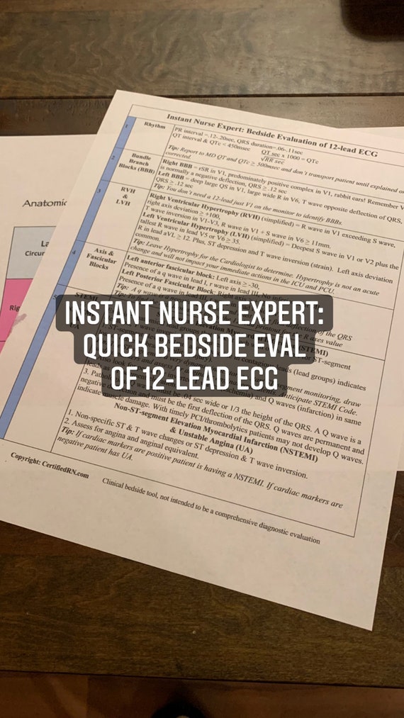 Instant Nurse Expert: Bedside Evaluation of 12-lead ECG | Etsy