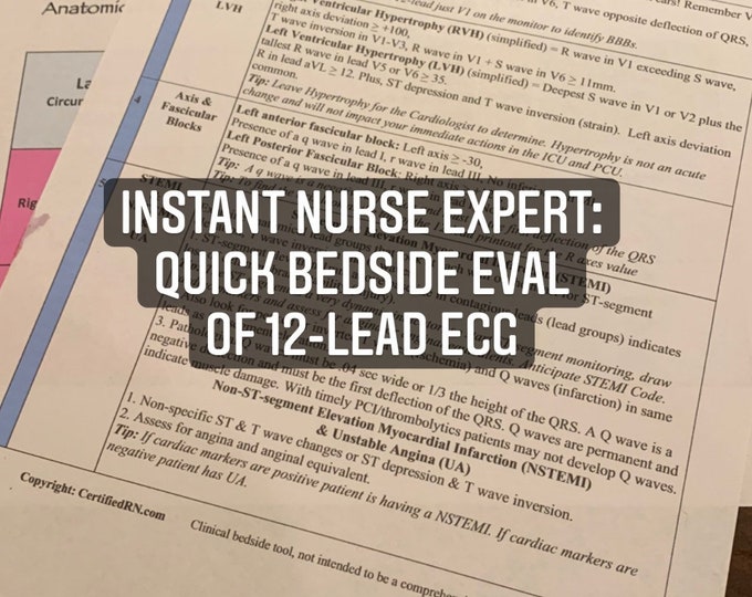 12-lead ECG Overlay to Detect STEMI/NSTEMI 2 Included - Etsy Canada