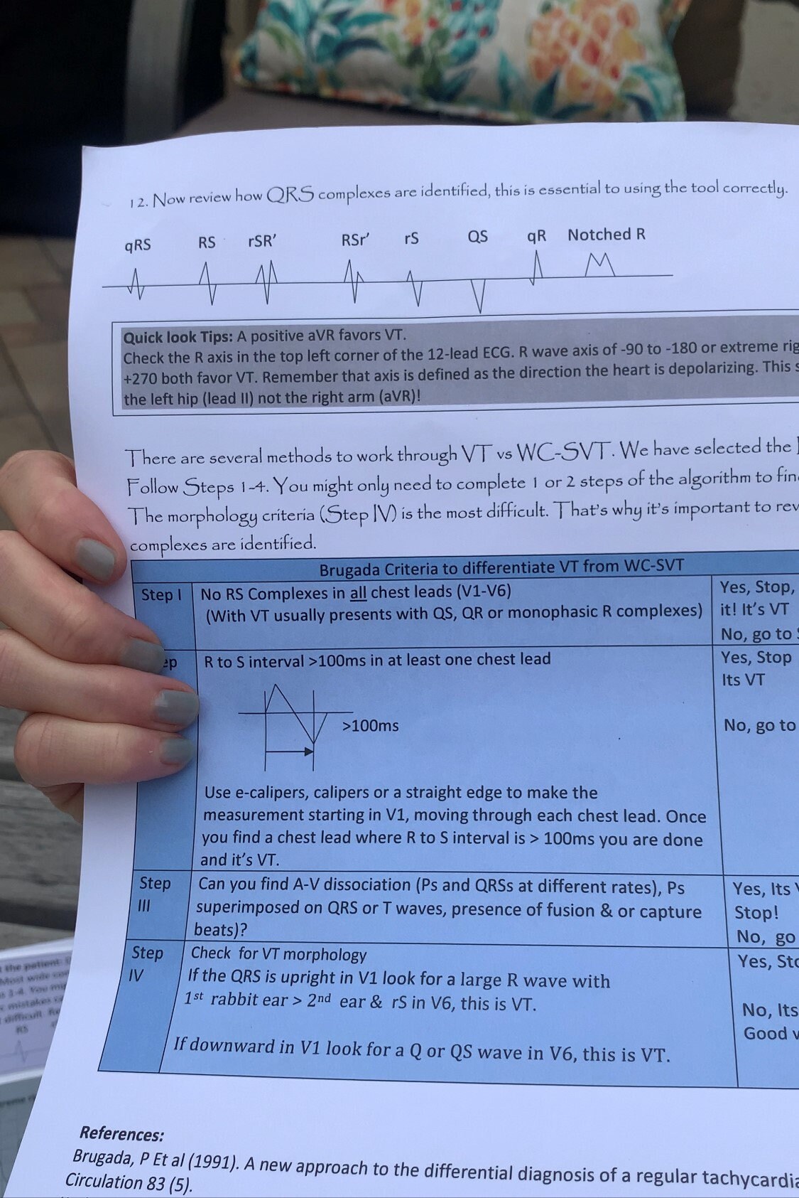 SVT Vs VTACH 12-lead ECG Overlay - Etsy