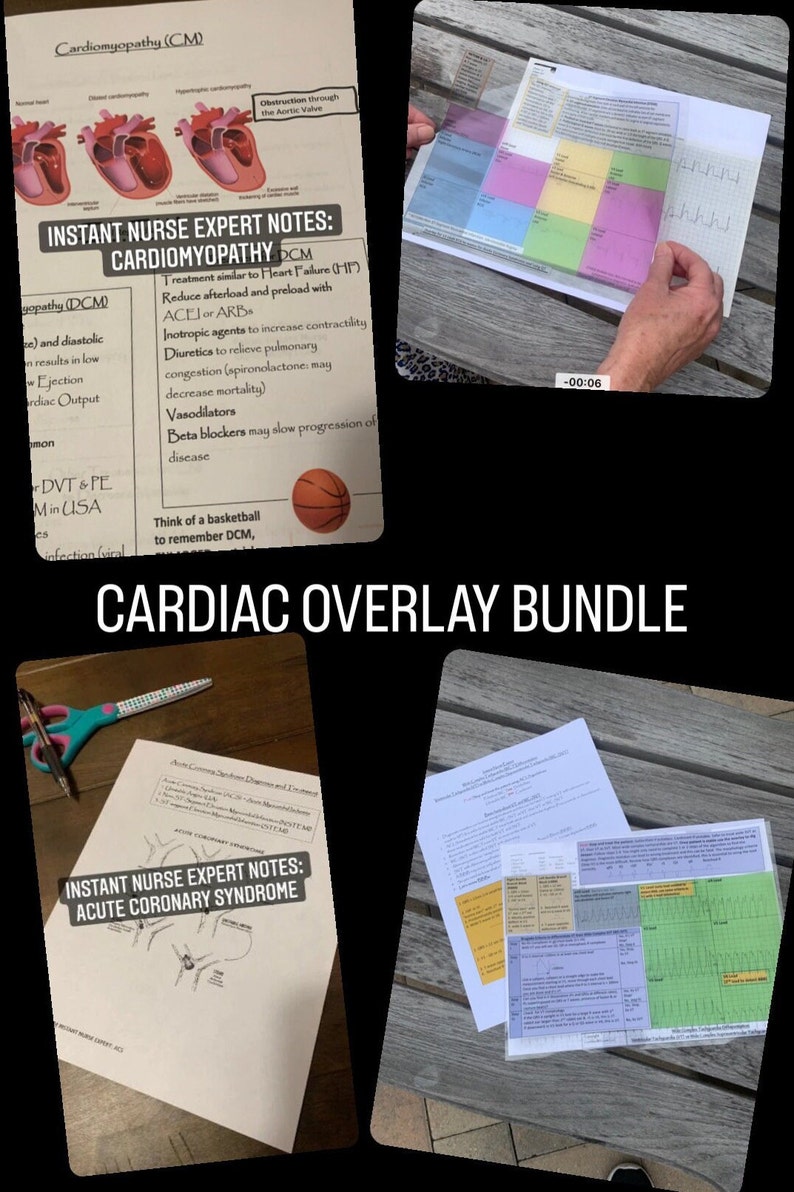 Cardiac Bundle: 2 12-lead ECG Overlays and 4 Instant Nurse Expert ...