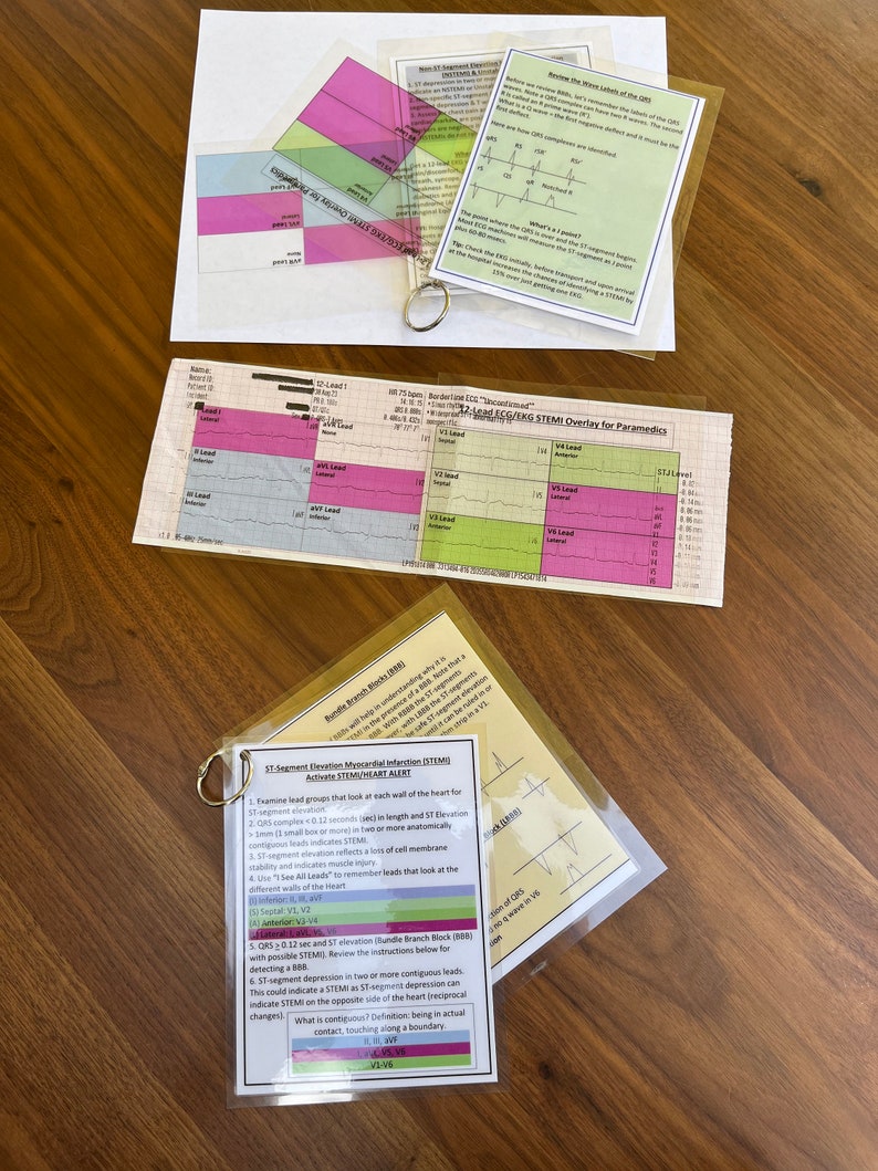 Paramedic 12-lead ECG/EKG Overlay to Detect STEMI - Etsy