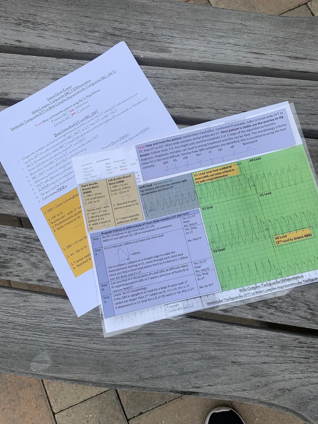 SVT Vs VTACH 12-lead ECG Overlay - Etsy