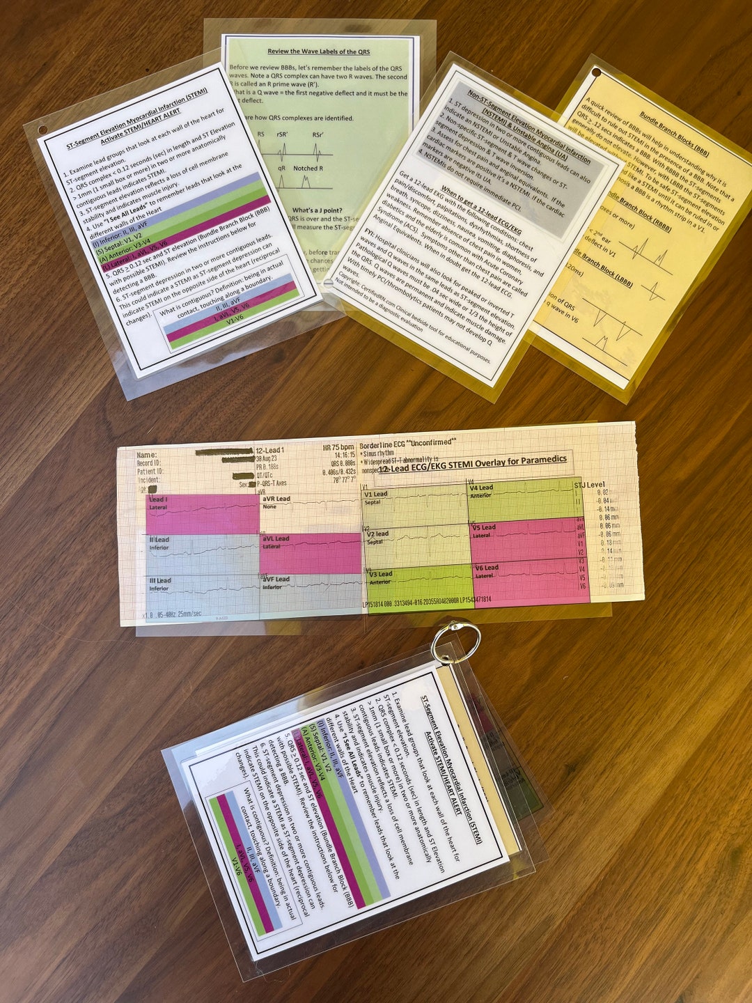 Paramedic 12-lead ECG/EKG Overlay to Detect STEMI - Etsy