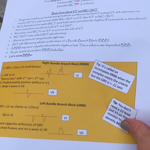 SVT Vs VTACH 12-lead ECG Overlay - Etsy