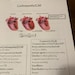 Instant Nurse Expert Notes: Cardiomyopathy - Etsy