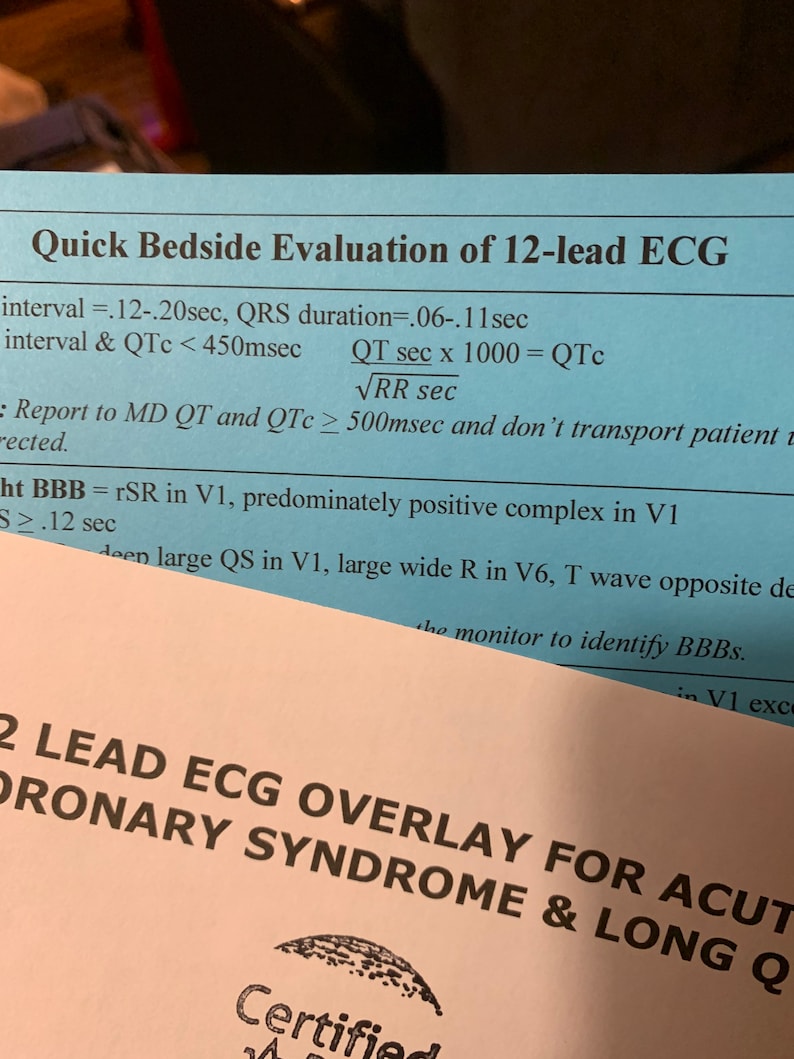 12-lead ECG Overlay to Detect STEMI/NSTEMI ( 2 Included) - Etsy