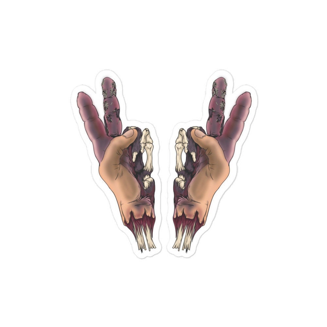 5 Stages of Decay Hand - Human Decomposition - Forensic Science ...