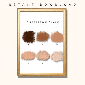 Fitzpatrick Scale Postera4a3a1 Digital Print | Etsy
