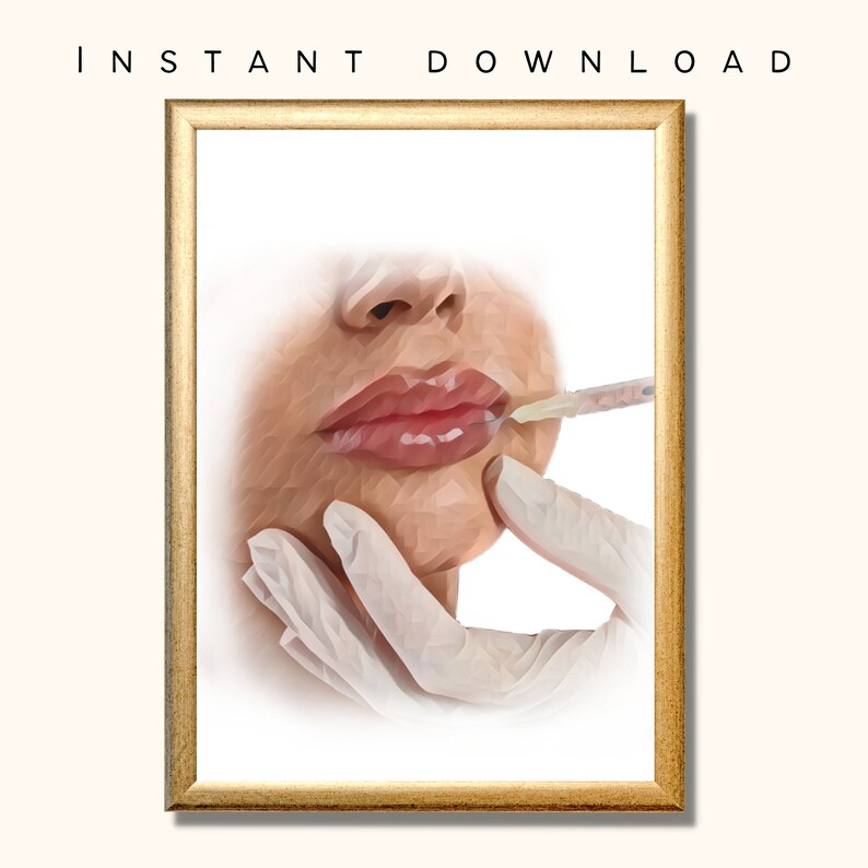 Lip Filler Poster, Estheticians Decor, Botox Nurse - Etsy