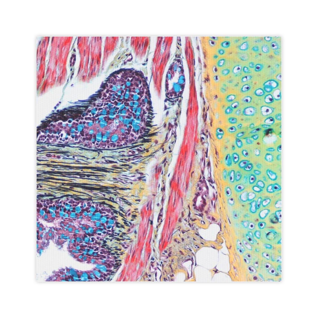 Movat Pentachrome Stain Canvas Photo Tile,histology Special Stains Wall ...