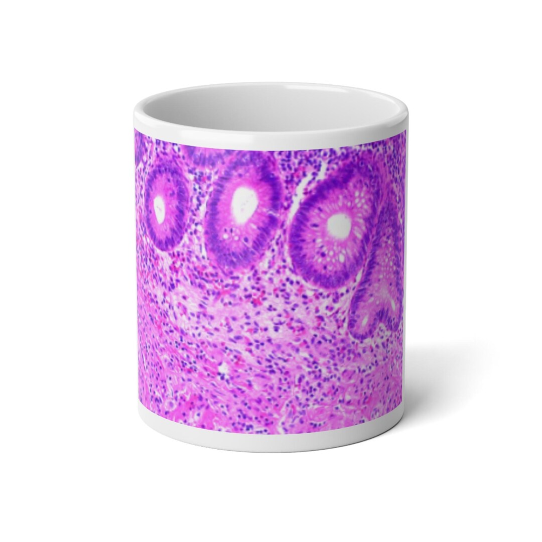 Histology Stain Jumbo Mug, 20oz - Etsy