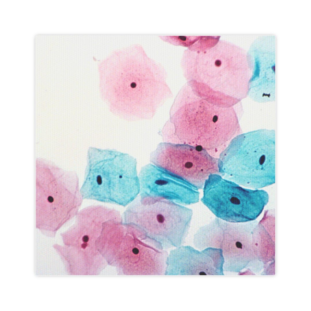 Pap Stain Canvas Photo Tile: Cytology Stains Wall Art - Etsy