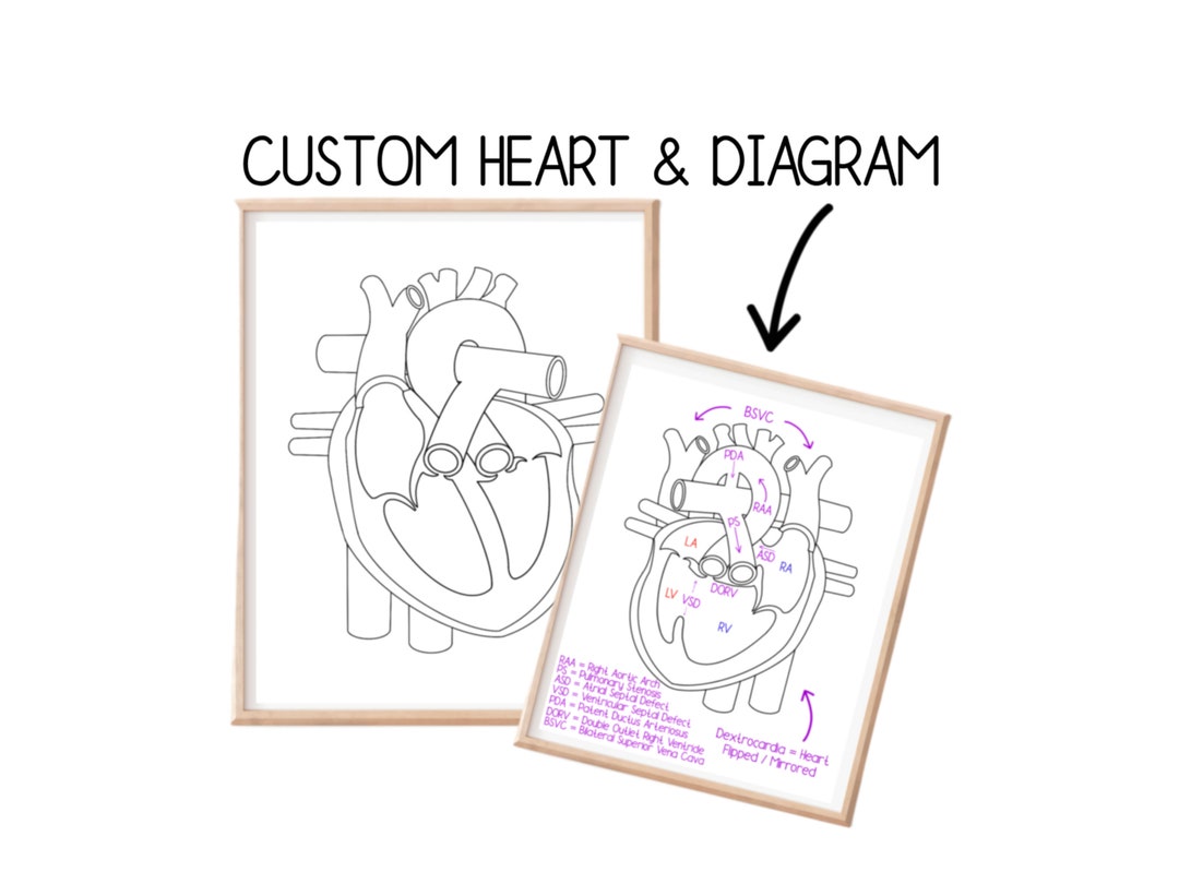 Custom CHD Heart Illustration Diagram Digital File Simple Black & White ...
