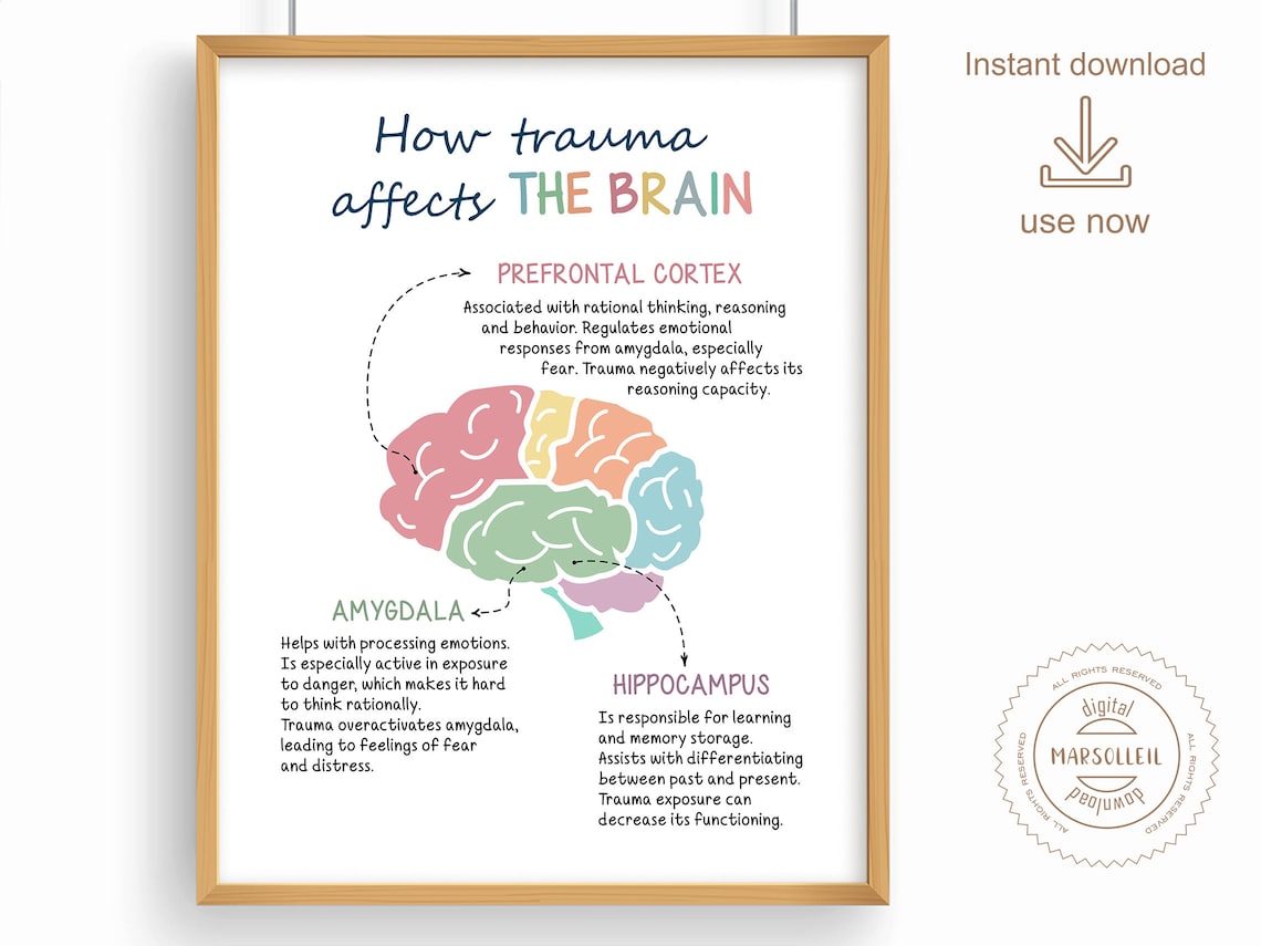 How Trauma Affects the Brain, Trauma and the Brain, Brain Anatomy ...