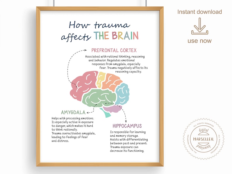 How Trauma Affects the Brain, Trauma and the Brain, Brain Anatomy ...