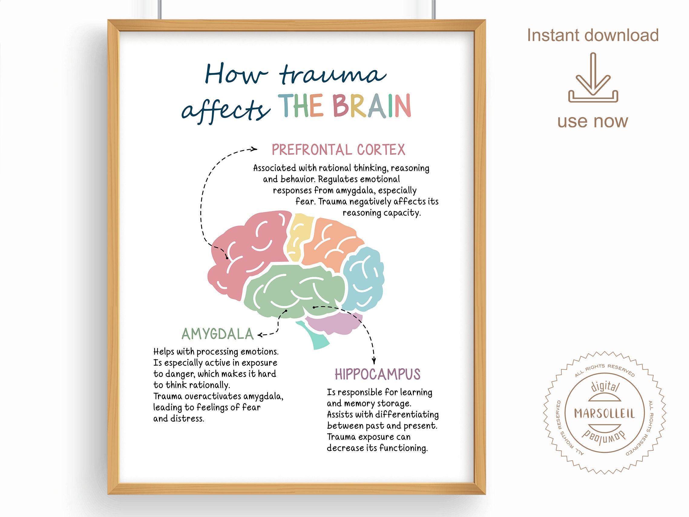 How Trauma Affects the Brain, Trauma and the Brain, Brain Anatomy ...
