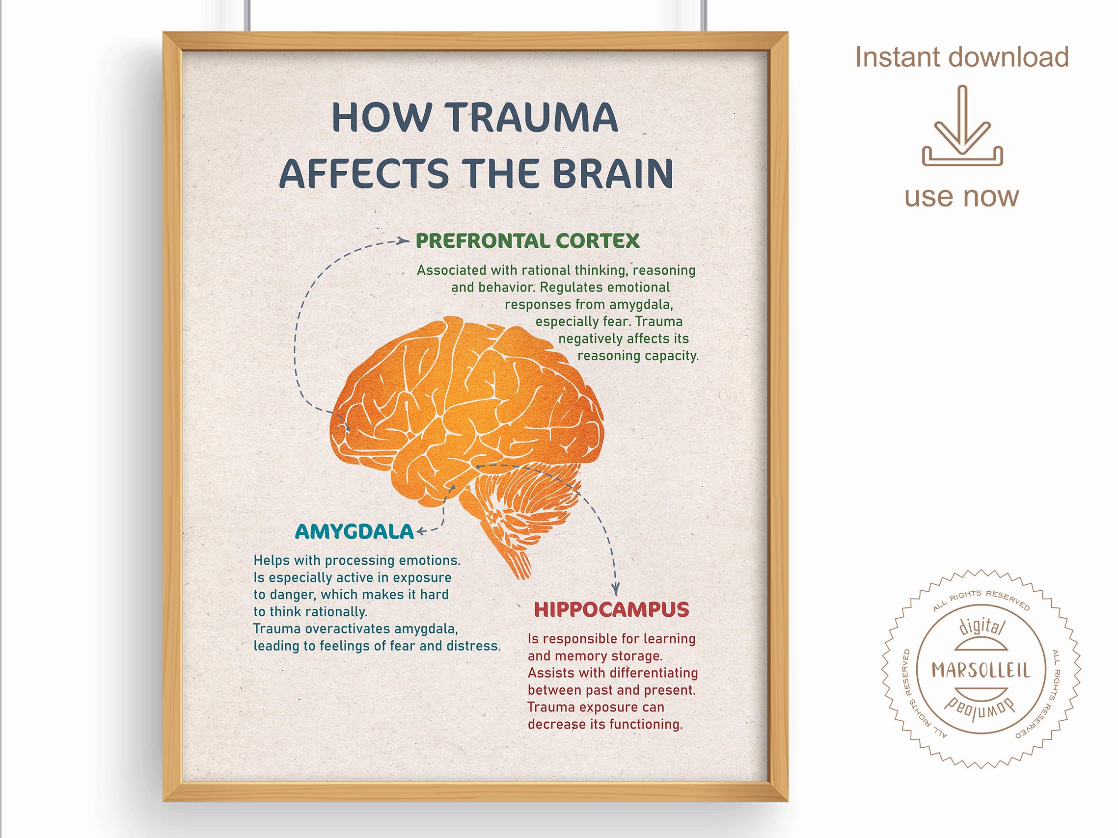 How Trauma Affects the Brain, Trauma Healing, Mental Health, Therapy ...
