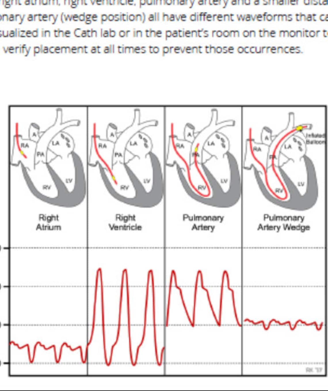 DIGITAL ICU Essentials for Nurses Swan Ganz Pulmonary Artery | Etsy
