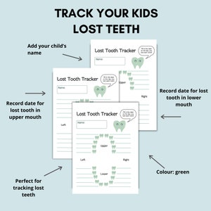 Kids’ Lost Tooth Tracker in Green | Children's Lost Tooth Chart | Lost ...