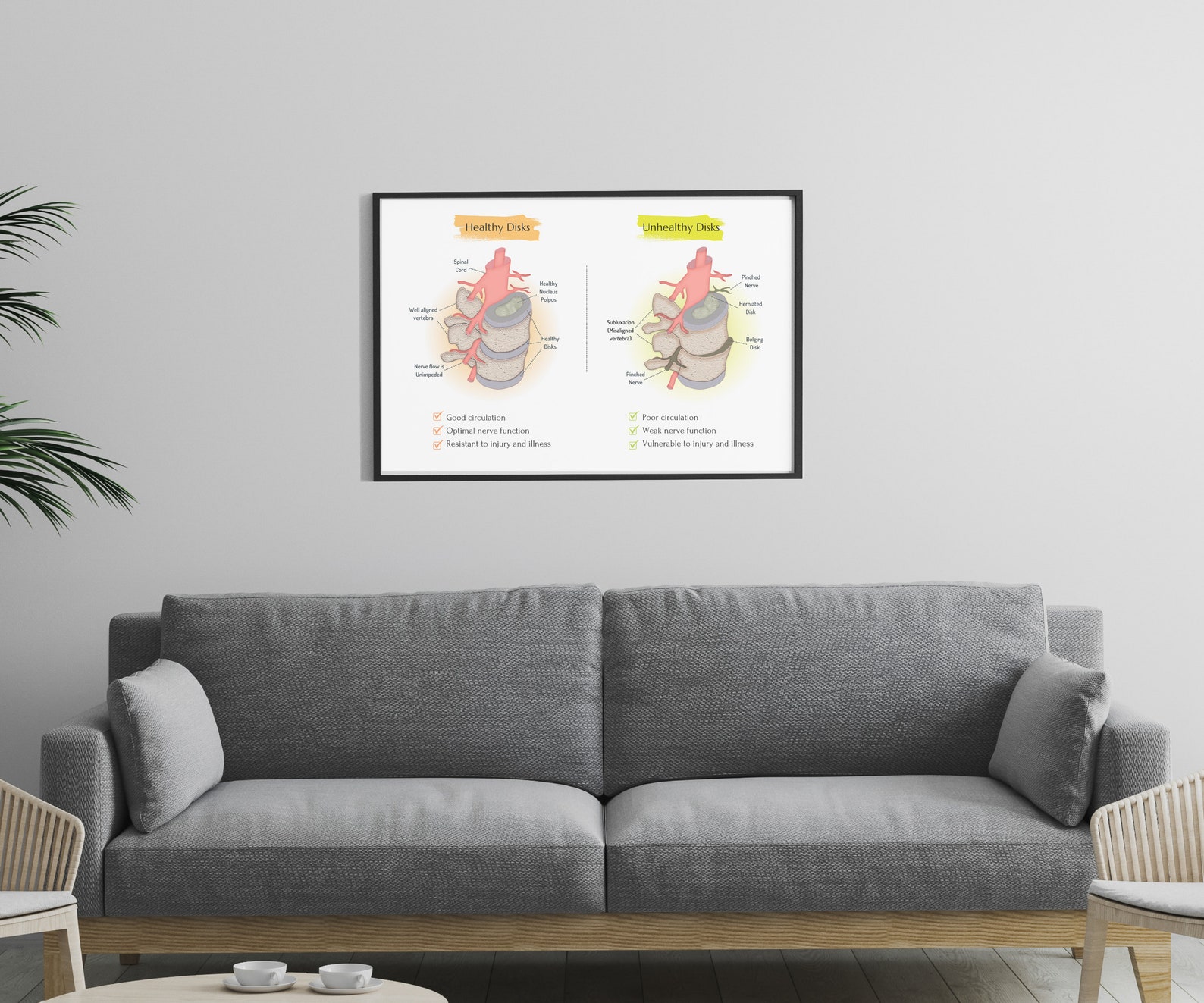 Chiropractic Wall Art, Patient Education. Vertebra, Subluxation ...