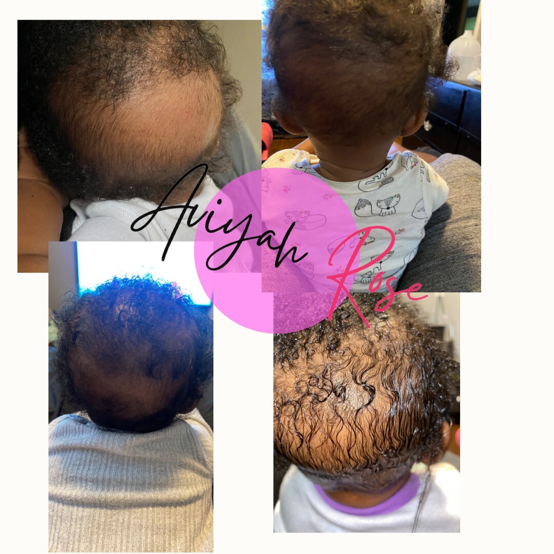 Stimulating Hair Growth Oil Hair Growth Serum Roots 2 Roots for Babies ...