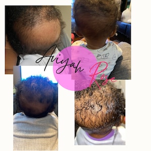 Stimulating Hair Growth Oil Hair Growth Serum Roots 2 Roots for Babies ...