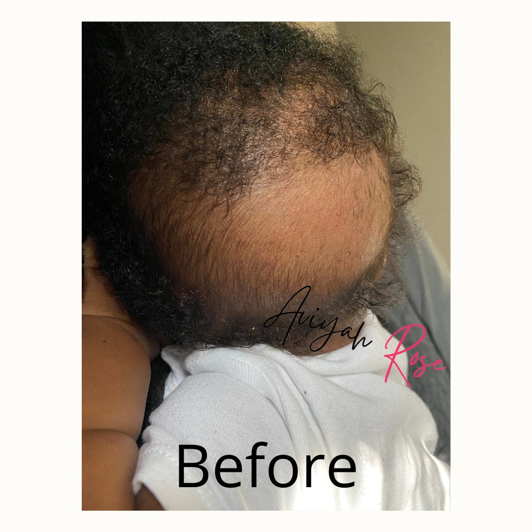 Stimulating Hair Growth Oil Hair Growth Serum Roots 2 Roots for Babies ...