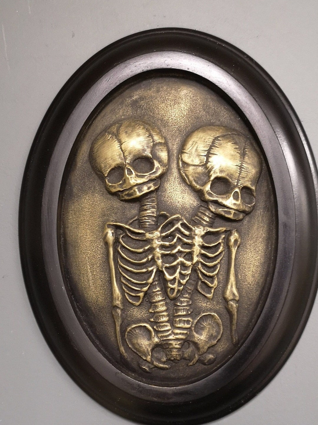 Conjoined Twins Skeleton Framed Wall Sculpture in Brass - Black and ...