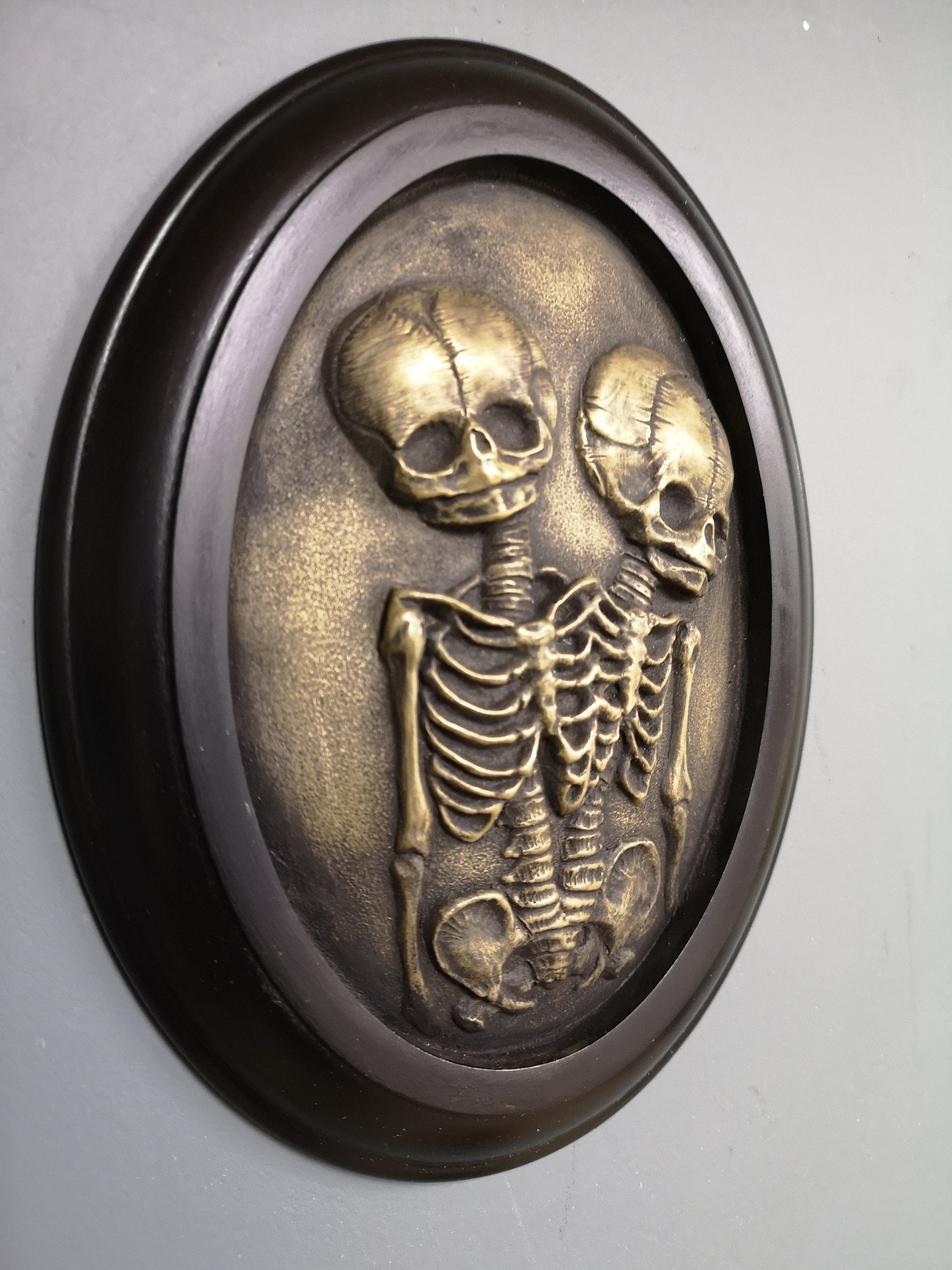 Conjoined Twins Skeleton Framed Wall Sculpture in Brass Black and Gold ...