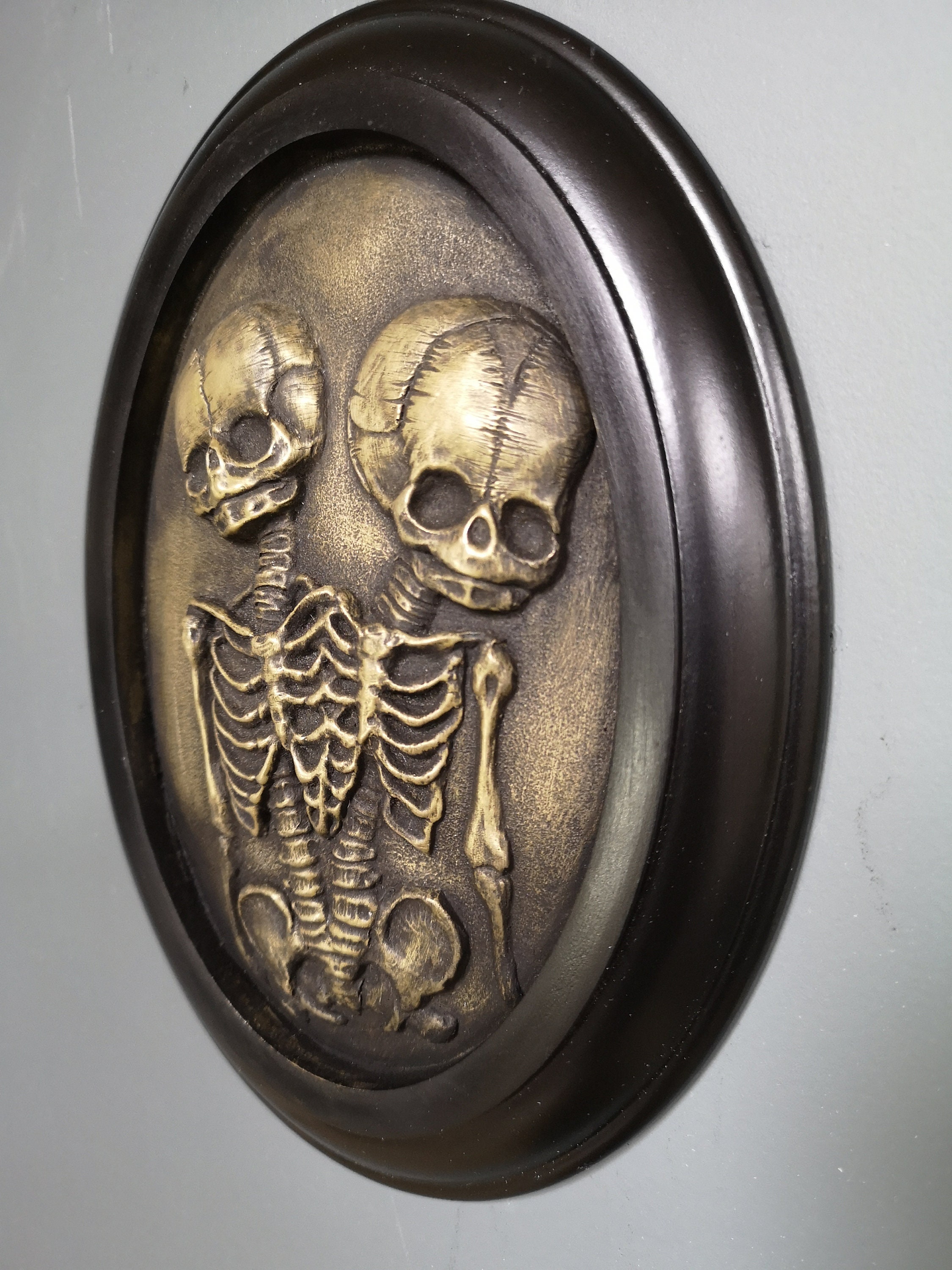Conjoined Twins Skeleton Framed Wall Sculpture in Brass Black and Gold ...