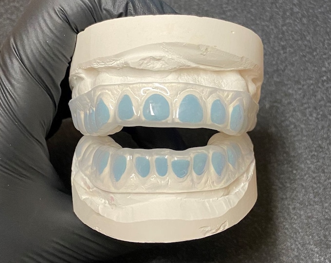 Custom Teeth Whitening Bleaching Trays Upper & Lower + FREE Case - Etsy UK