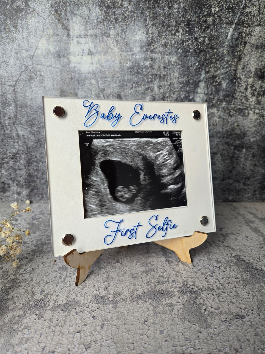 Personalized Ultrasound Picture Frame: Baby Scan Photo Keepsake - Etsy